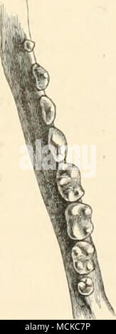 Molar teeth upper and lower right side number 13,14,18,19, and 20. one ...