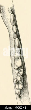 Molar teeth upper and lower right side number 13,14,18,19, and 20. one ...