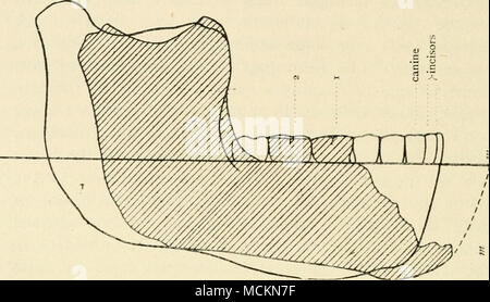 Piltdown 1 molar Stock Photo - Alamy
