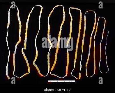 Adult tapeworm (Taenia saginata) in the human intestine, 1986. Image ...