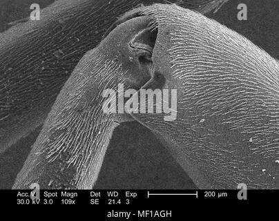 Unidentified wasp leg coated with sensorial hairs (Setae), depicted in ...