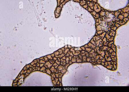 Congealed blood cells under the microscope Stock Photo - Alamy