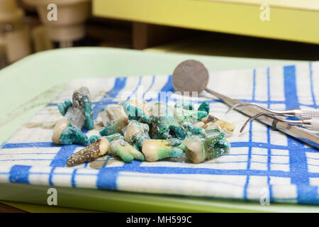 Rotten extracted teeth and dentistry tools displayed on a tray Stock ...