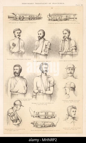 Broken Cricket Bat Stock Photo - Alamy