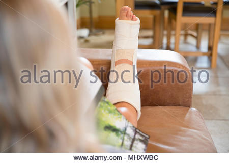 Close-up Of Woman Leg In Plaster Cast Using Crutches While Walking ...