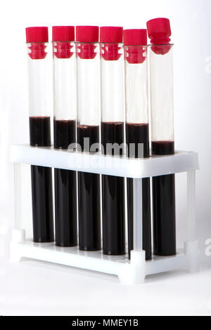 laboratory flasks, blood, red liquid, tests, viruses, dirty blood ...