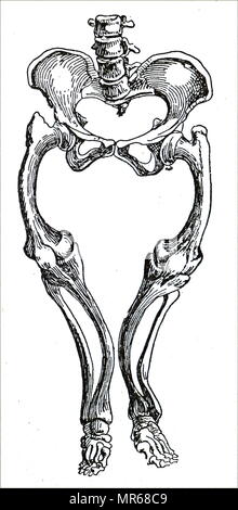 Skeleton Of Rickets Stock Photo: 5549791 - Alamy
