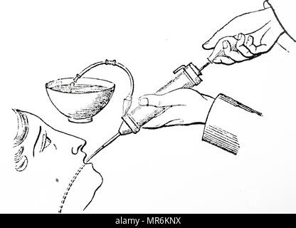 Diagram depicting a syringe pump used to help poisoning victims. Dated ...