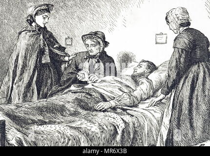 ENGRAVING-AMPUTATION OF A LEG Stock Photo - Alamy