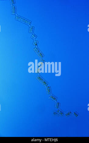 Tabellaria flocculosa diatom, light micrograph Stock Photo - Alamy