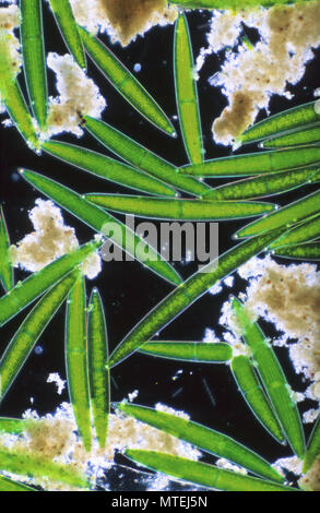 Closterium algae, light micrograph Stock Photo - Alamy