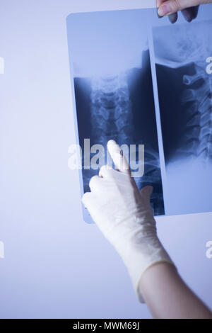 Medical hospital x-ray lowe back pain spine and hips traumatology scan ...