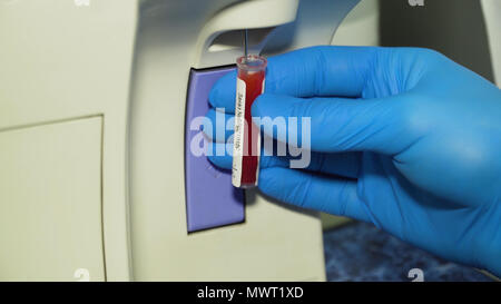 Peripheral Blood Smear Test Medical check up test tube with biological ...