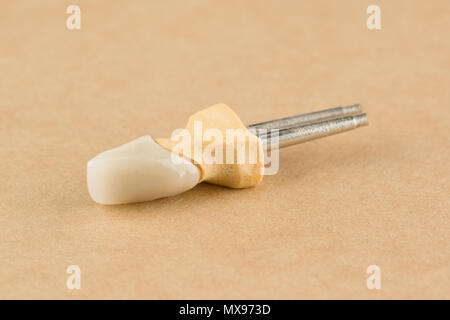 cast and cermet dental structures for restoration of teeth Stock Photo ...
