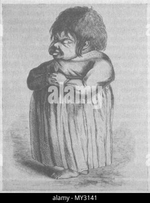 . English: Cretinism as shown in Virchow Deutsch: Zeichnung einer Frau ...