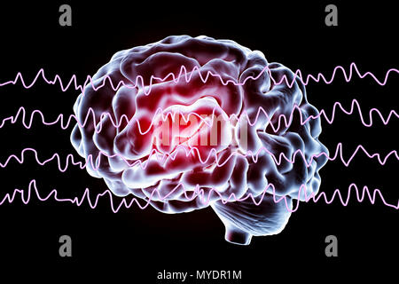 Electroencephalogram Eeg Uses Procedure Results