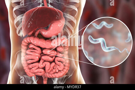 Campylobacteriosis, conceptual illustration. Campylobacter jejuni is a ...
