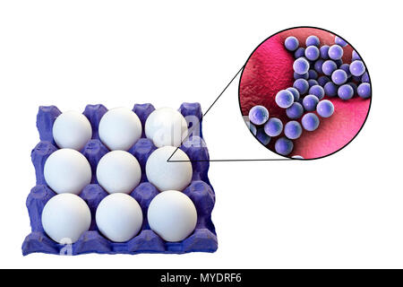 Staphylococcal food poisoning, conceptual illustration. S. aureus is ...