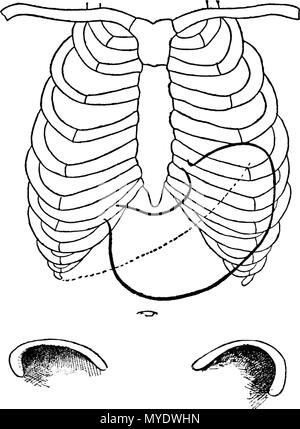 . Français : Figure 3 (d'après Rosenheim); ESTOMAC NORMAL, INSUFFLÉ ...