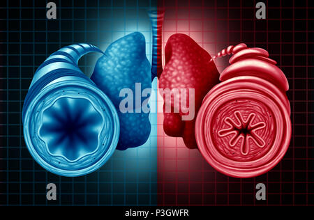 Asthma bronchial tube constricted breathing problem concept caused by ...