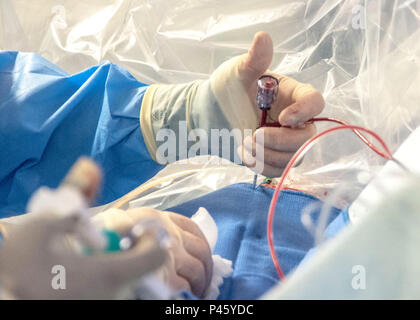 Stent in the opening Stock Photo - Alamy