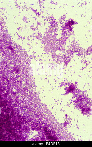 Light micrograph of the Gram-negative bacteria Escherichia coli, a ...