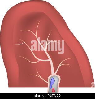 Spleen. realistic internal organ of Lymphatic system. vector ...