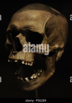 Skull of a man 35-40 years old killed with bone arrows. 3500 BC ...
