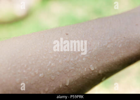 Human skin texture with water drops. Close up. Body care concept Stock ...