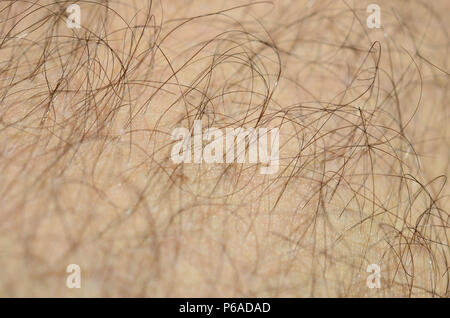 Closeup of curly leg hair Stock Photo: 310139410 - Alamy