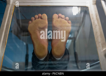 Flat foot, foot podoscope test Stock Photo - Alamy