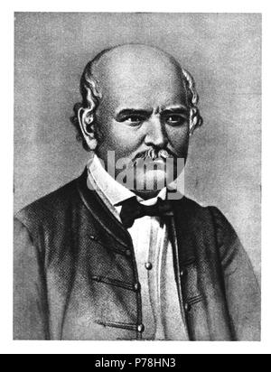 Ignaz Semmelweis, Ignaz Philipp Semmelweis (1818 – 1865) a Hungarian ...