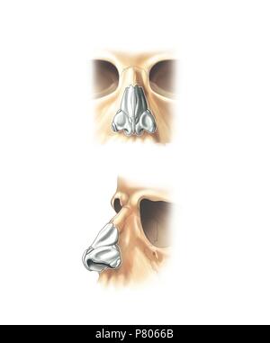 Human Skeleton Nasal cartilage Anatomy 3D Illustration Stock Photo - Alamy