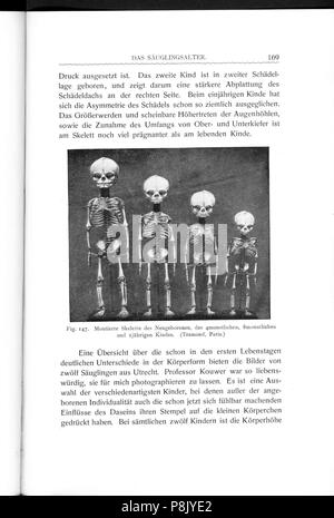 Stratz’s work, 'Körper des Kindes' (The Child’s Body), is a medical and ...