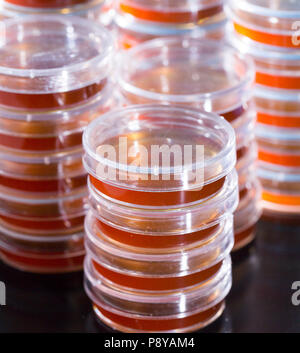 container with a urine sample for microbiological laboratory analysis ...