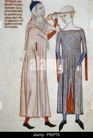 Illustration of trepanation. Miniature. 14th century. Treatise on Stock ...