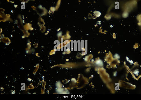 house dust in the microscope Stock Photo - Alamy
