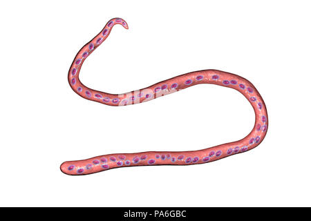 Computer illustration of Mansonella streptocerca, a roundworm nematode ...