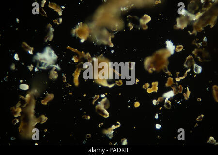 house dust in the microscope Stock Photo - Alamy