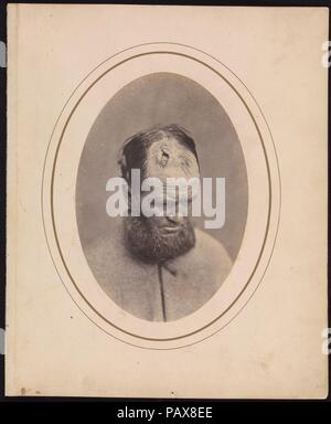Private John Parkhurst, Company E, Second New York Heavy Artillery ...
