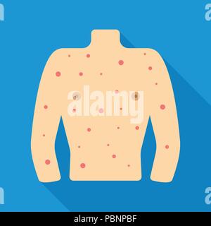 vector illustration of contact dermatitis. Allergy, dermatology Stock ...