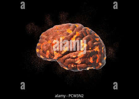 Exploding brain. Conceptual computer illustration of a human brain ...