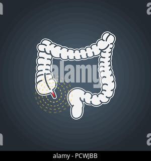 Appendicitis. inflammation of the appendix. large intestine on dark ...