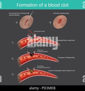 Human blood vessel with red blood cells. Blood vein with macro ...
