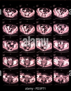 Sequence of horizontal sections of a female human brain, MRI scans, magnetic resonance imaging ...