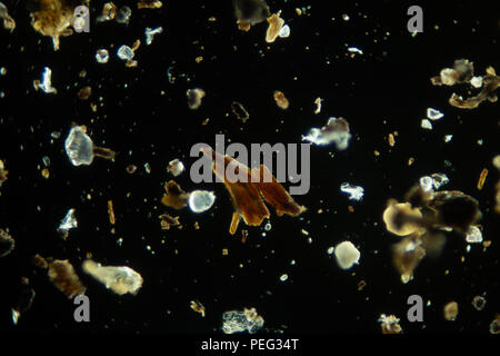 house dust in the microscope Stock Photo - Alamy