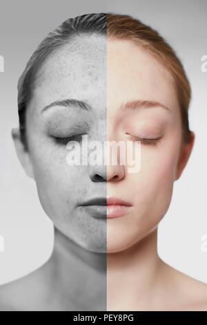 Composite image showing the damage sun exposure has done to a woman's ...