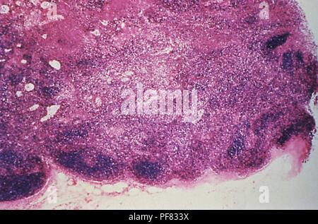 Lymph node, light micrograph Stock Photo - Alamy