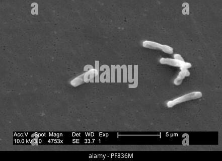 Gram-positive Clostridium difficile bacteria revealed in the stool ...