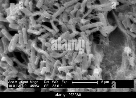 SEM of Clostridium difficile bacteria Stock Photo - Alamy